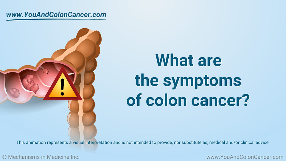 Animation - What are the Symptoms of Colon Cancer?